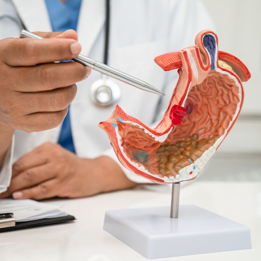 Gastroenterology - psv hospital